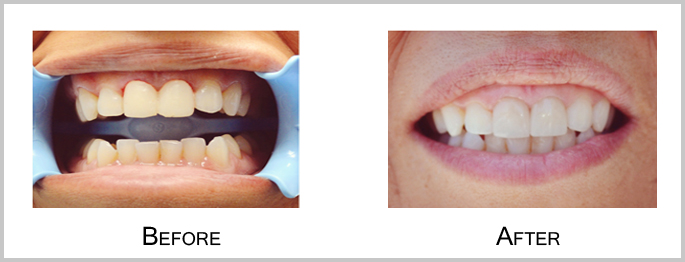 The Gallery of Canyon Dental Celebrates Our Success